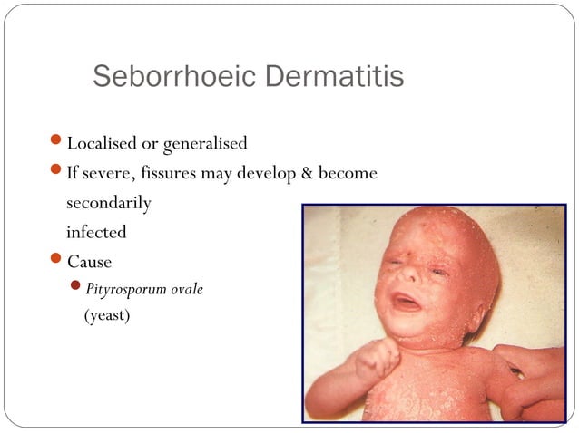 Common neonatal skin problems | PPT | Skin and Dermatology | Diseases ...