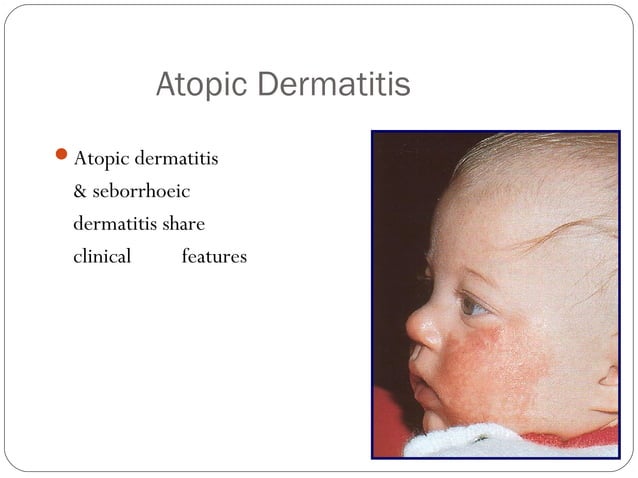 Common neonatal skin problems | PPT | Skin and Dermatology | Diseases ...
