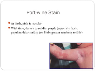 Common neonatal skin problems | PPT