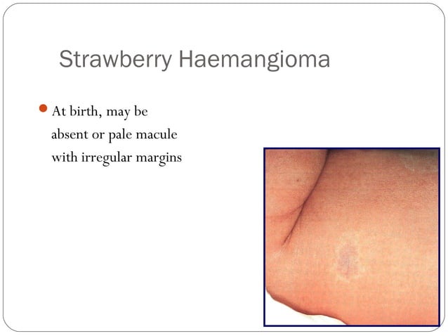 Common neonatal skin problems | PPT | Skin and Dermatology | Diseases ...