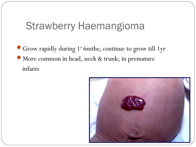 Common neonatal skin problems | PPT | Skin and Dermatology | Diseases ...