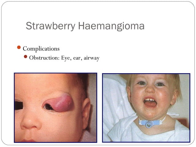 Common neonatal skin problems | PPT | Skin and Dermatology | Diseases ...