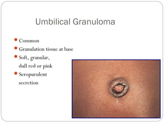 Common neonatal skin problems | PPT