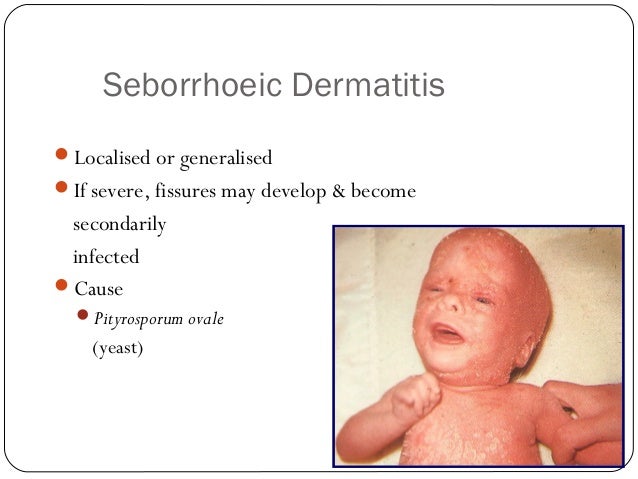Common neonatal skin problems