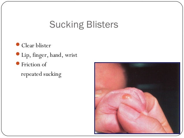 Common neonatal skin problems