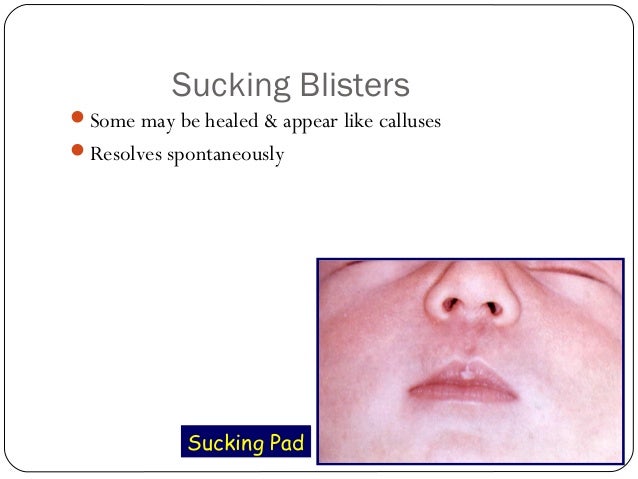 Common neonatal skin problems