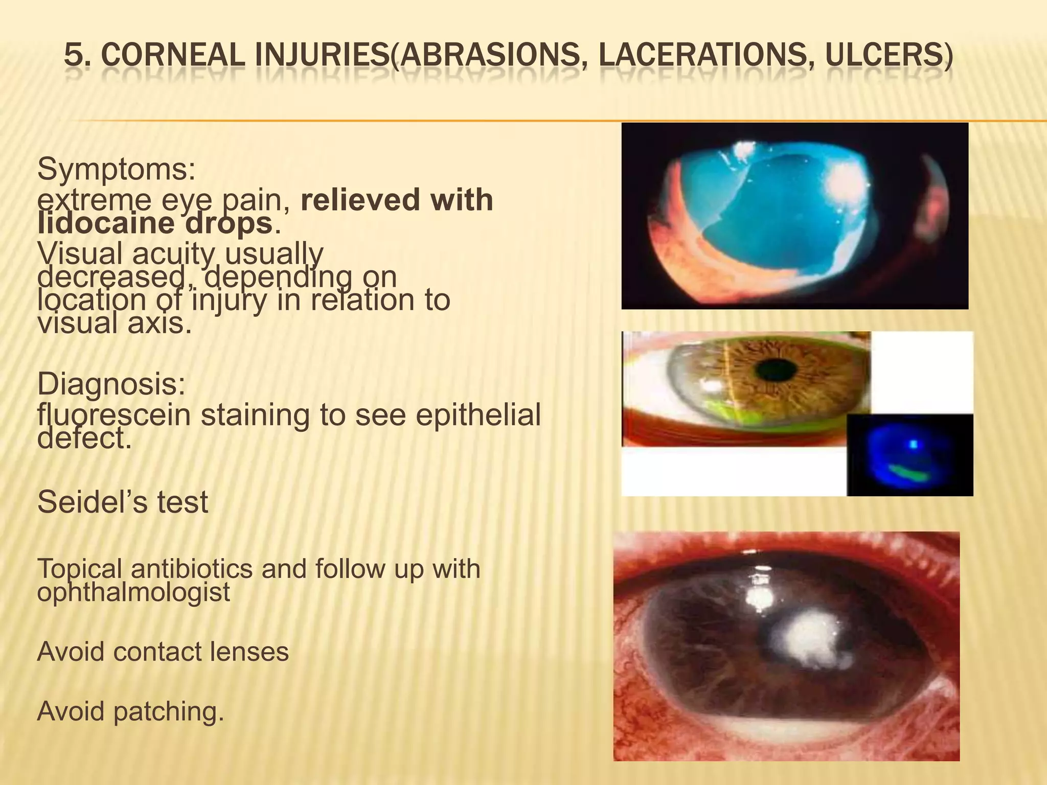 Common ocular emergencies | PPTX