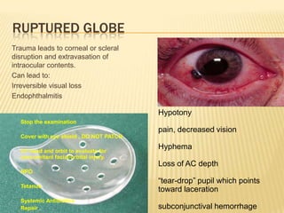 Common ocular emergencies | PPTX