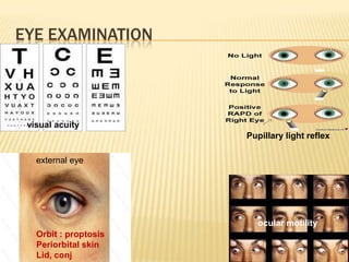 Common ocular emergencies | PPTX