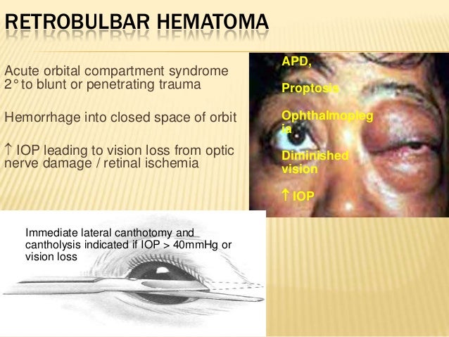 Common ocular emergencies