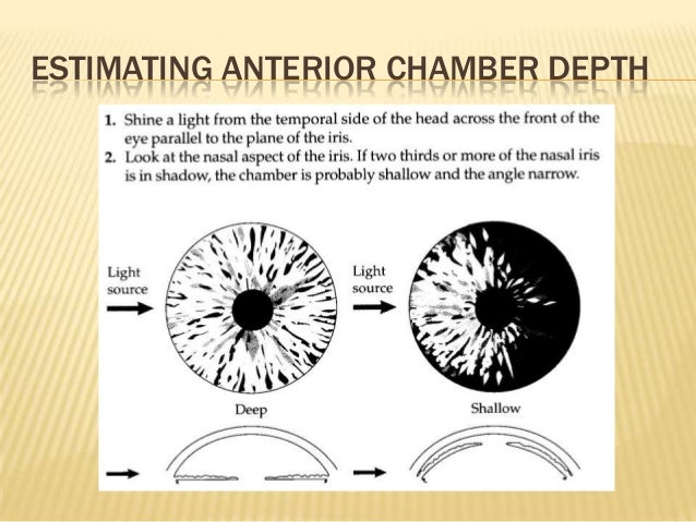 Common ocular emergencies