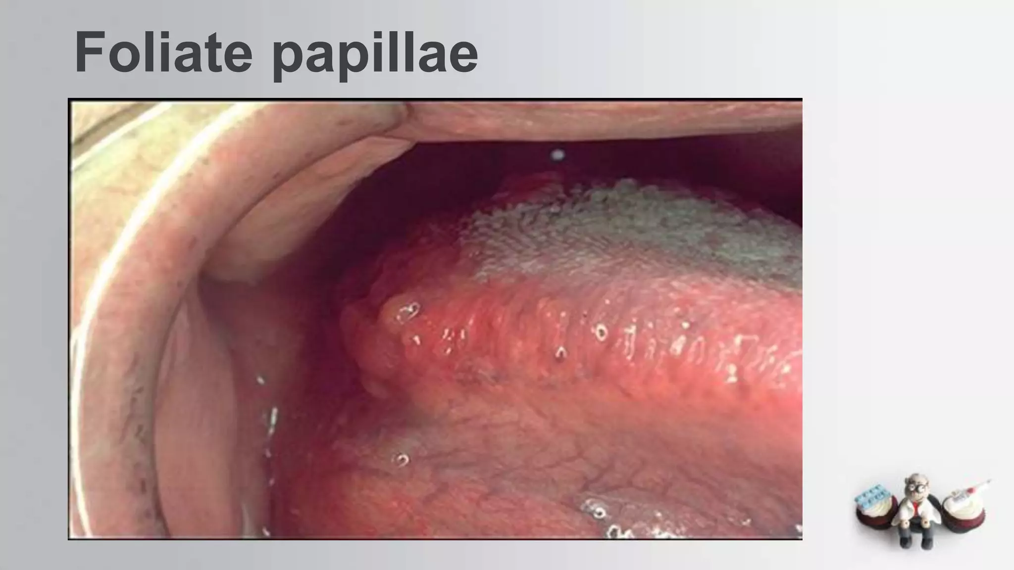 Common oral lesions2 | PPTX