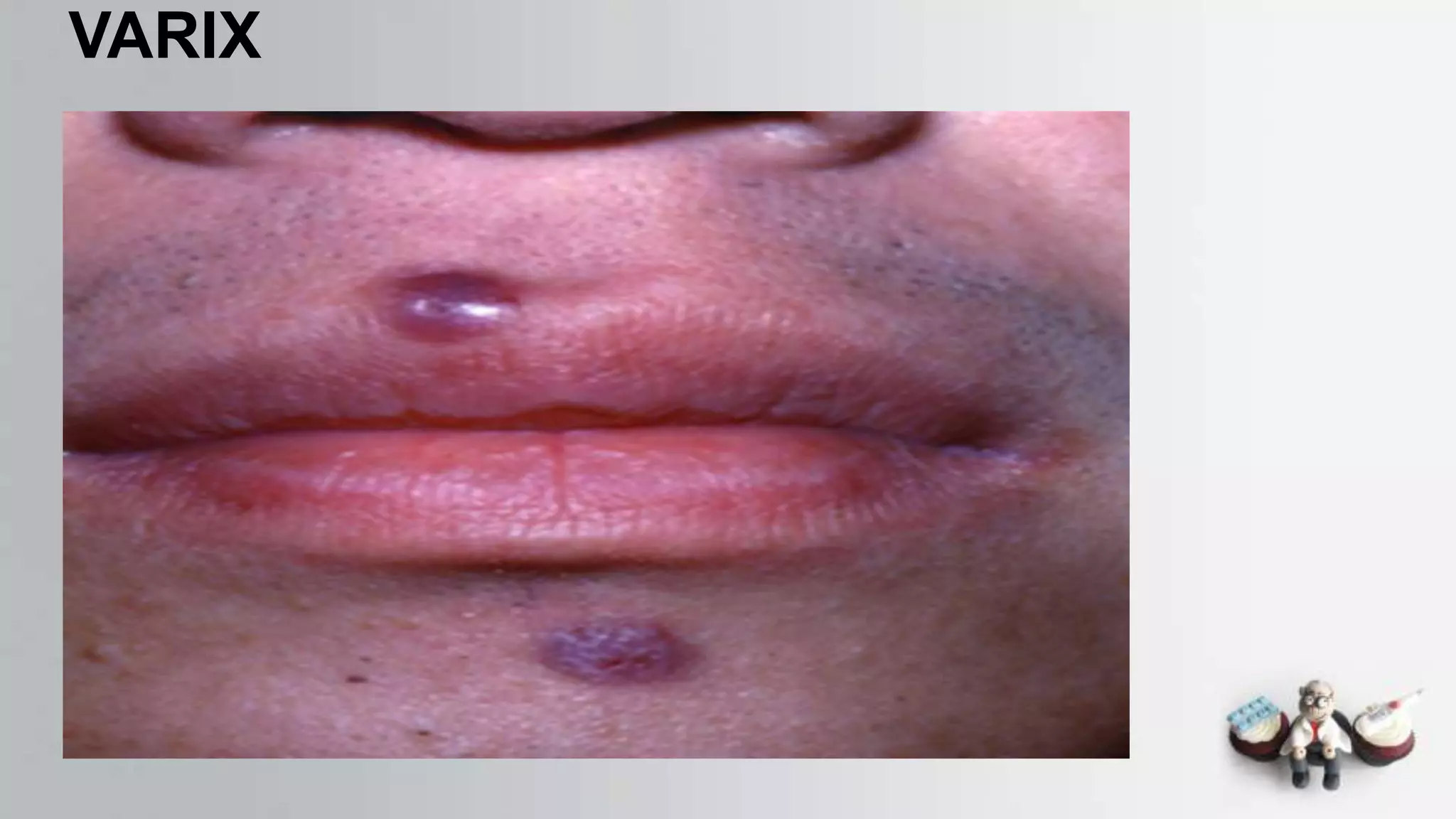 Common oral lesions2 | PPTX