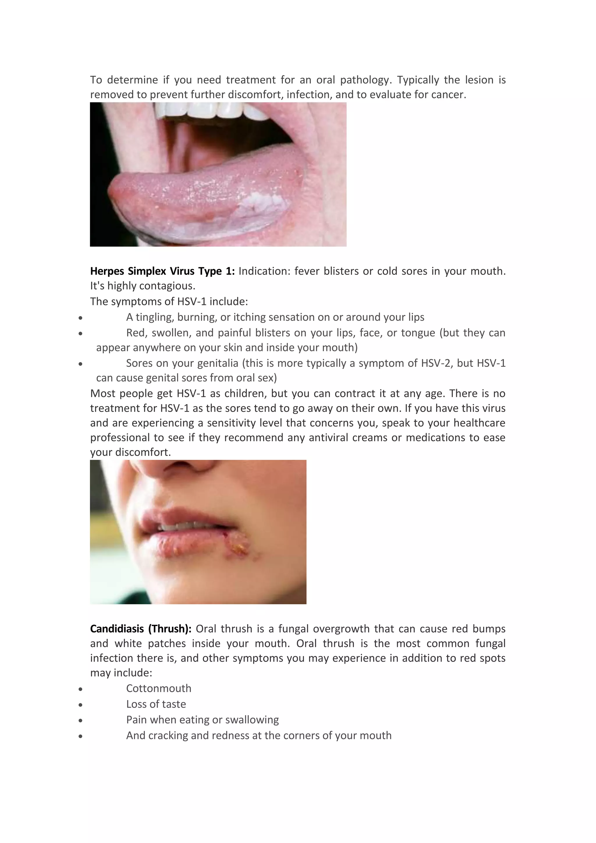 Common Oral Pathological Conditions.doc