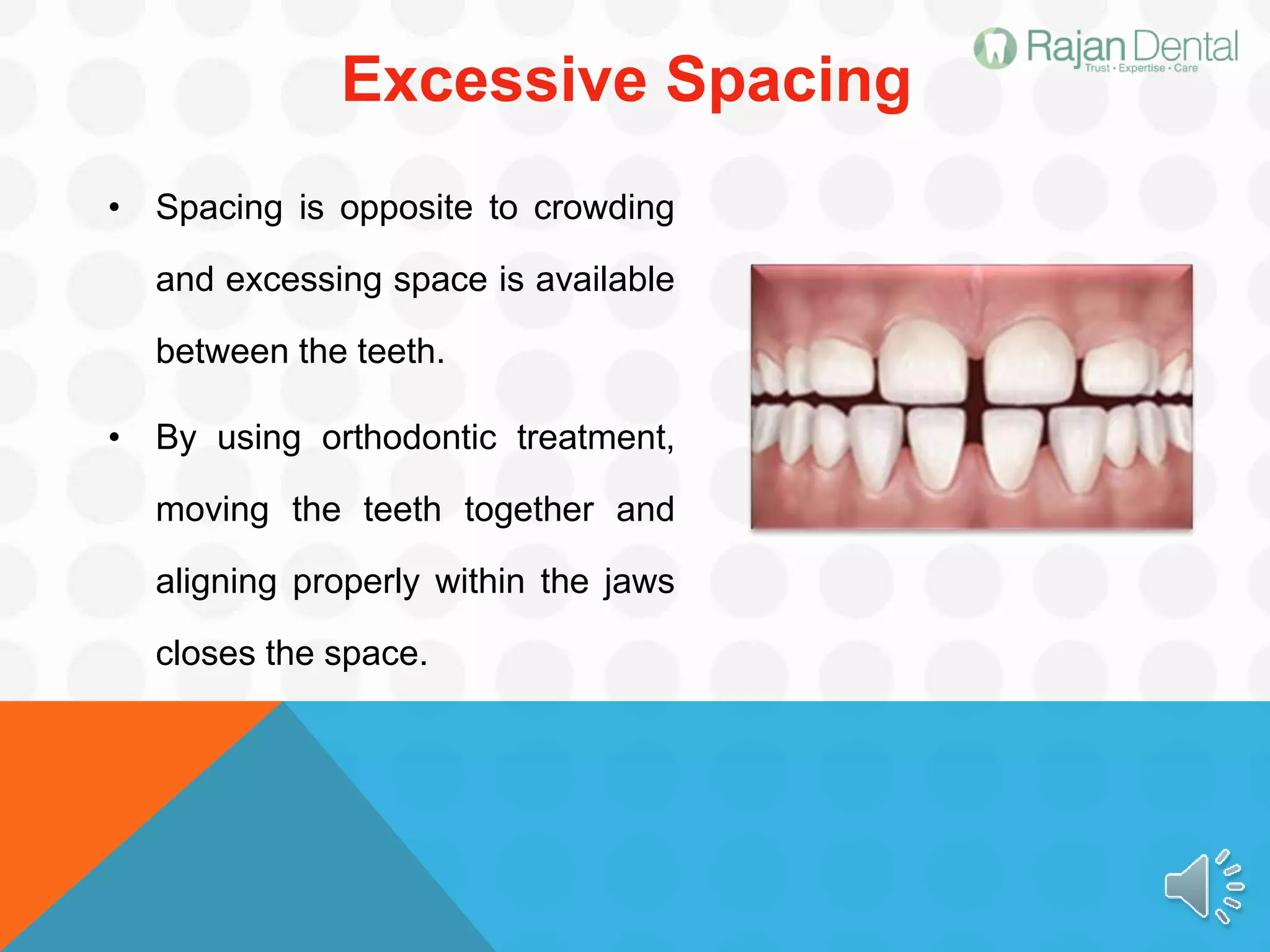 Common orthodontic problems | PPTX