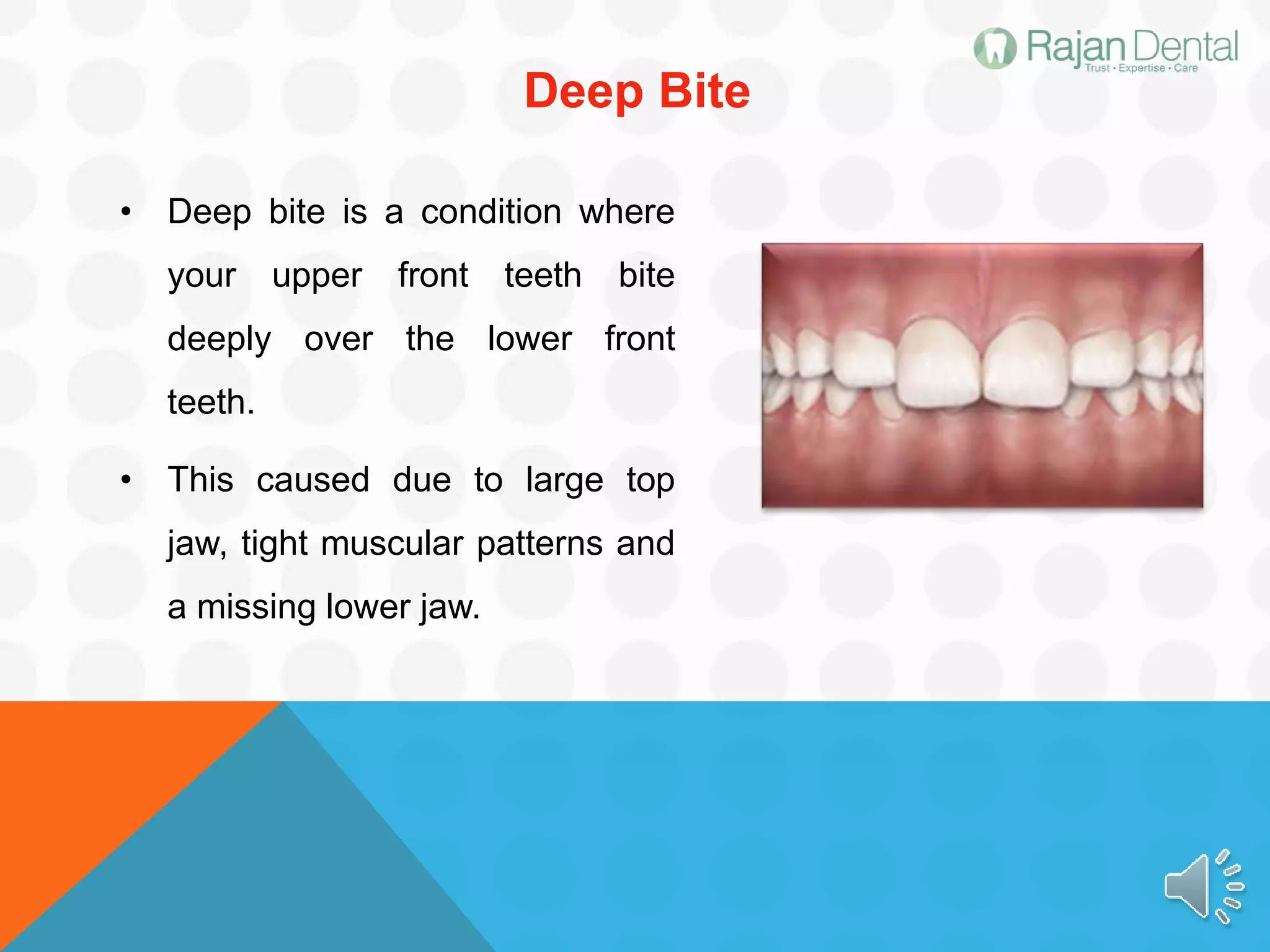 Common orthodontic problems | PPTX