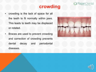 Common orthodontic problems | PPTX | Dental Health | Diseases and ...