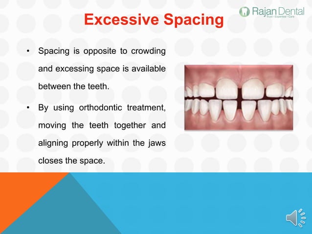 Common orthodontic problems | PPT