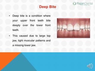 Common orthodontic problems | PPTX