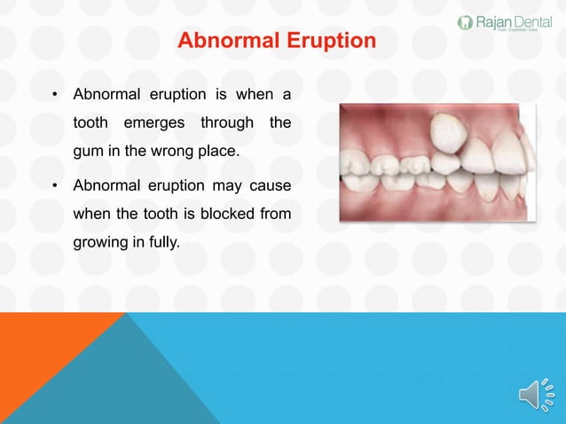 Common orthodontic problems | PPTX | Dental Health | Diseases and Conditions