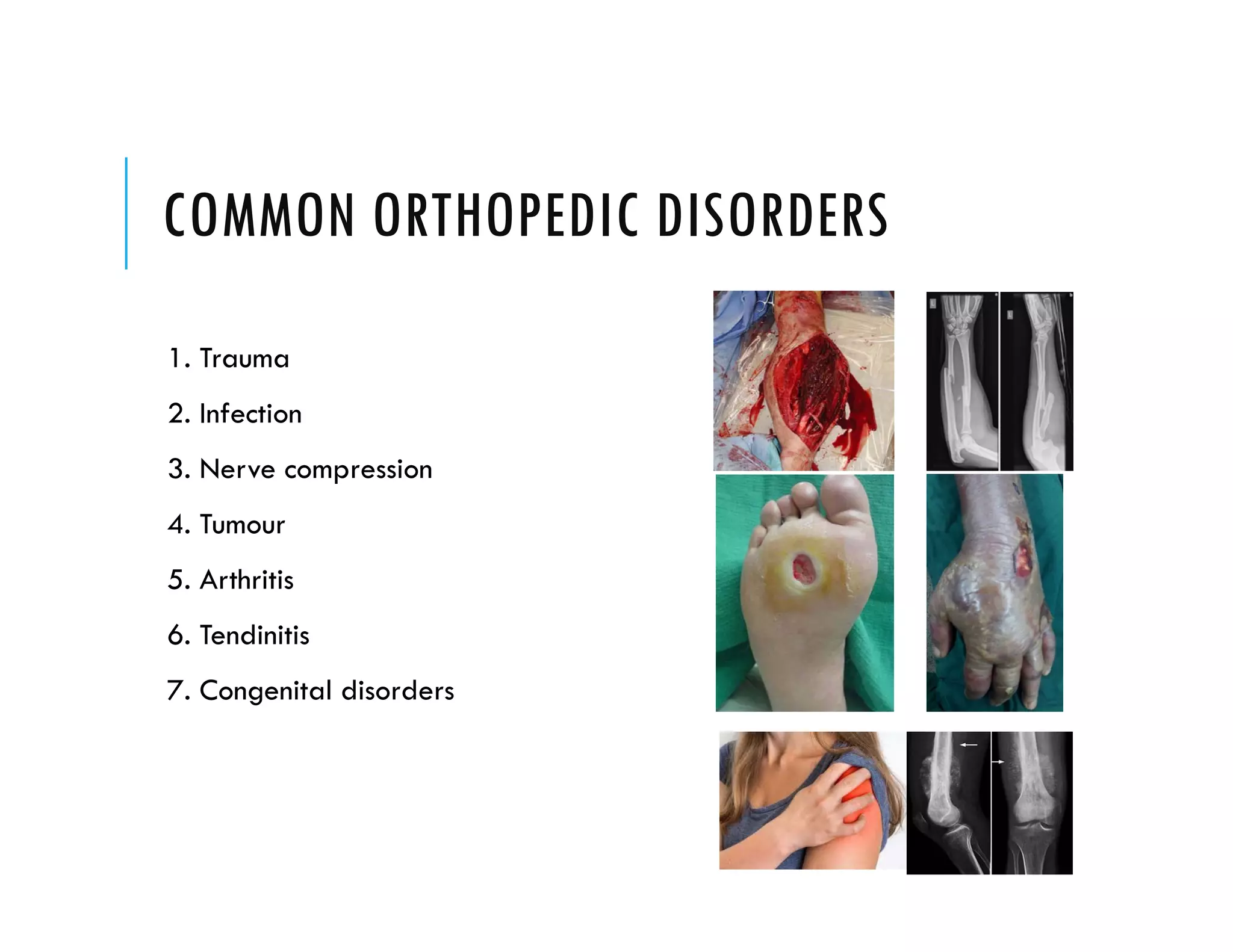 Common orthopedic disorders prevention vs cure | PDF