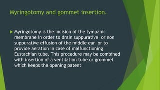 Myringotomy | PPTX
