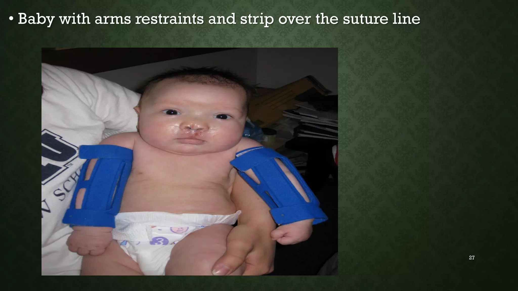 Common paediatric surgical conditions | PDF