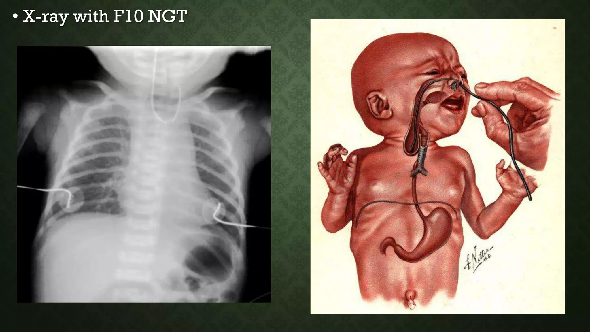 Common paediatric surgical conditions | PDF