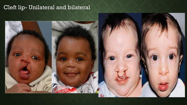 Common paediatric surgical conditions | PDF