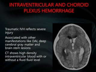 common pathologies of brain.pptx