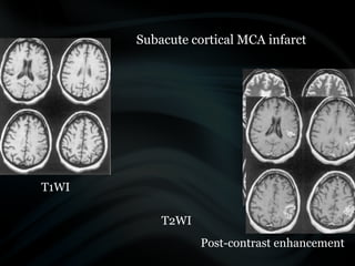 common pathologies of brain.pptx