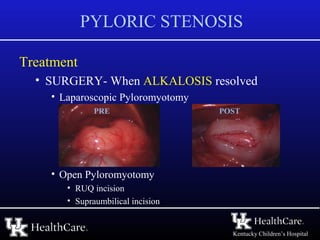 Common pediatric surgery referrals | PPT