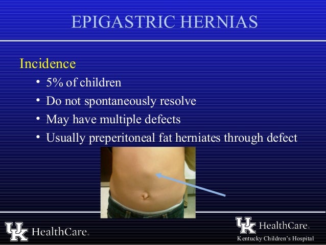 Common pediatric surgery referrals