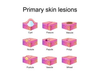 Common Pediatrics Rashes.ppt well explained pictutes | PPT