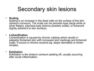 Common Pediatrics Rashes.ppt well explained pictutes | PPT