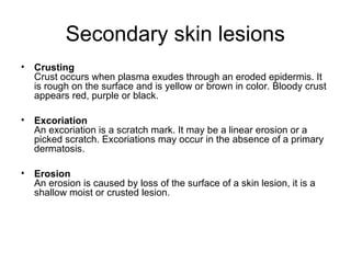 Common Pediatrics Rashes.ppt well explained pictutes | PPT