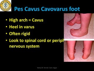 Common ped problem_2014 | PPT
