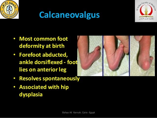 Common ped problem_2014