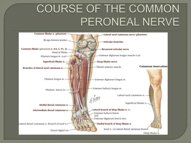 Common peroneal nerve lesions | PPTX