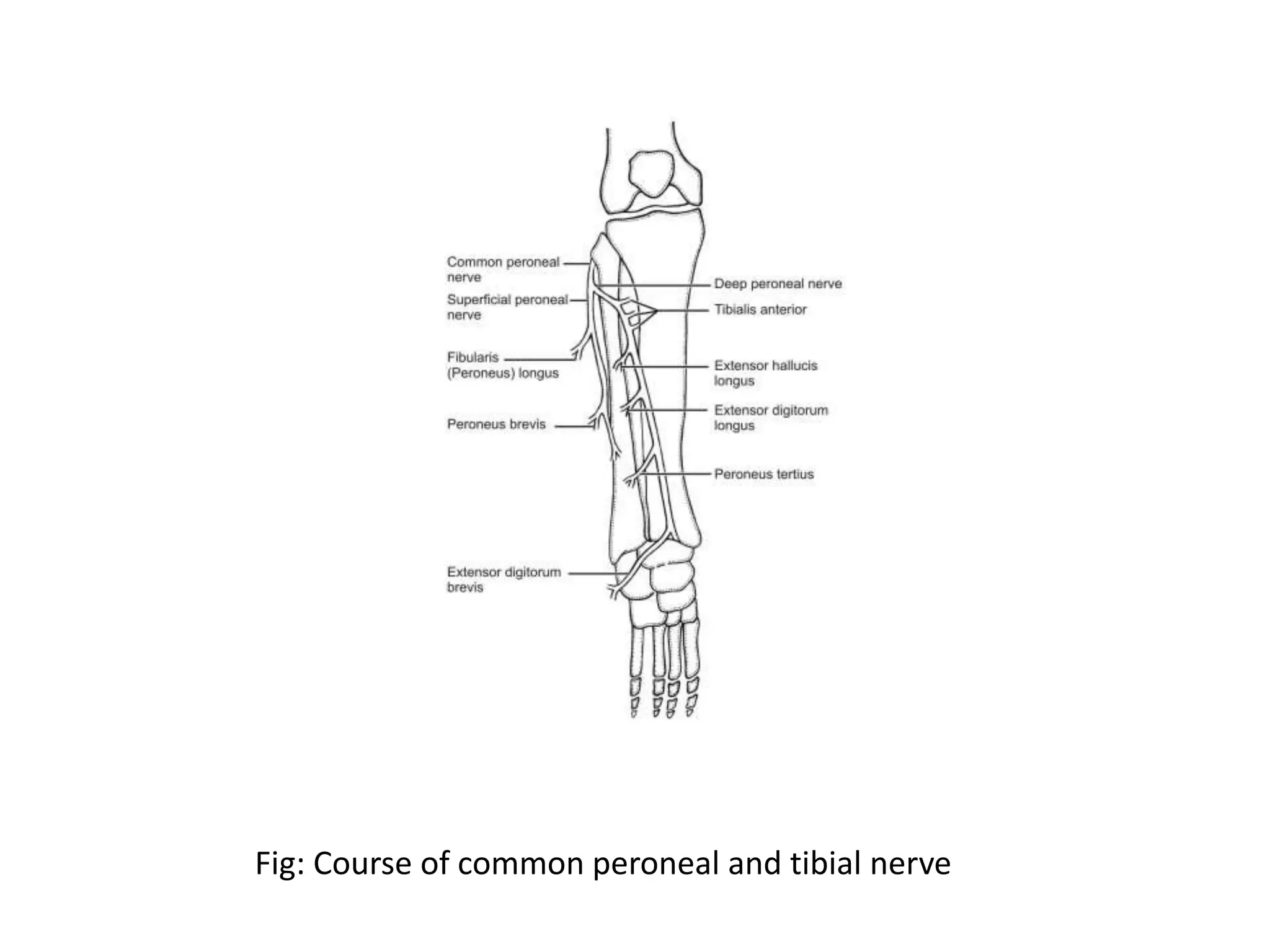 COMMON PERONEAL NERVE PALSY.pptx full ppt | PPTX