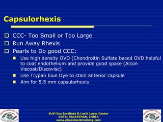 Common pitfalls while learning phacoemulsification dr suresh k pandey ...