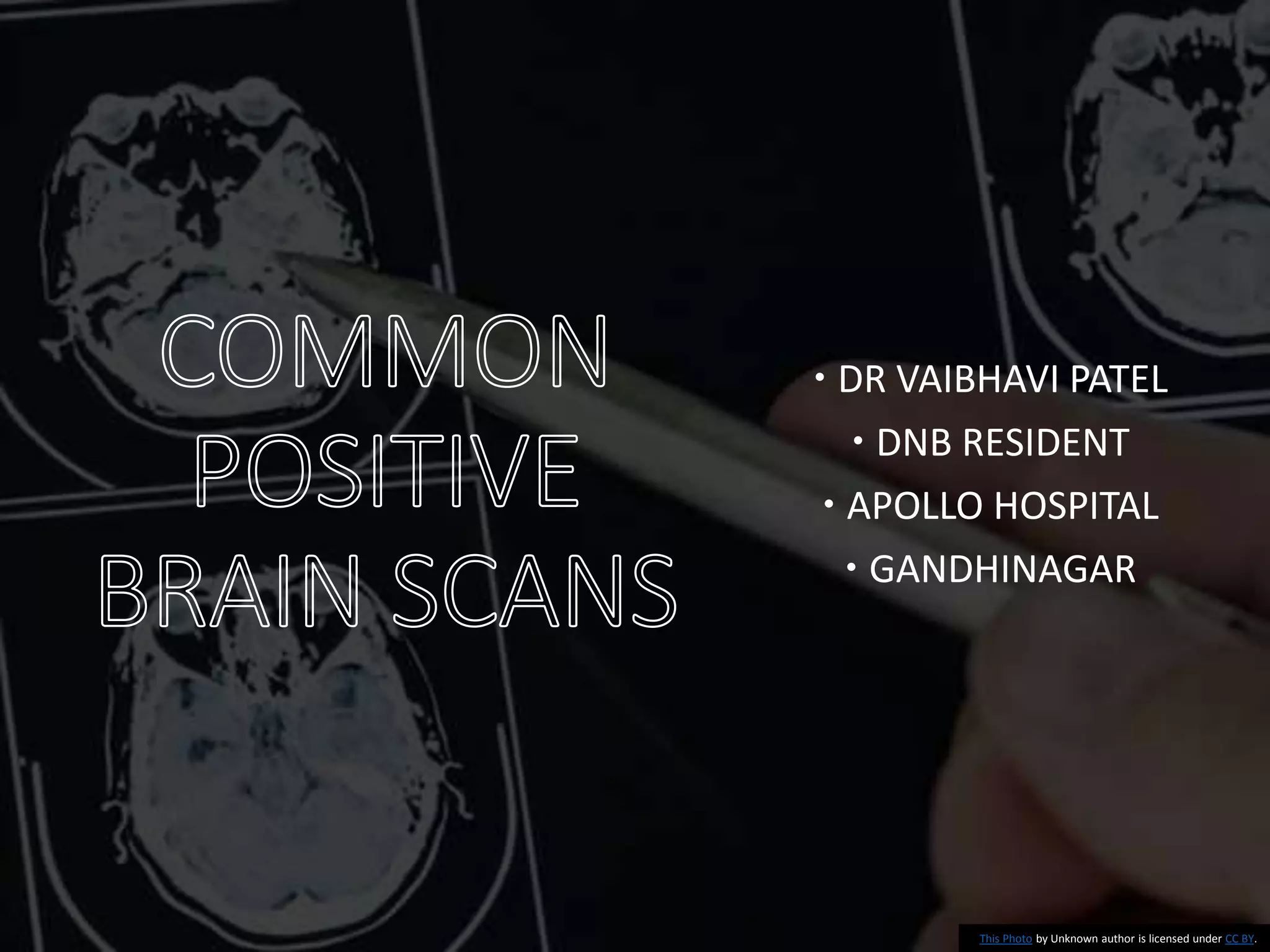 COMMON POSITIVE BRAIN SCANS.pptx