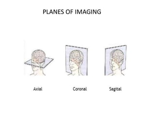 COMMON POSITIVE BRAIN SCANS.pptx