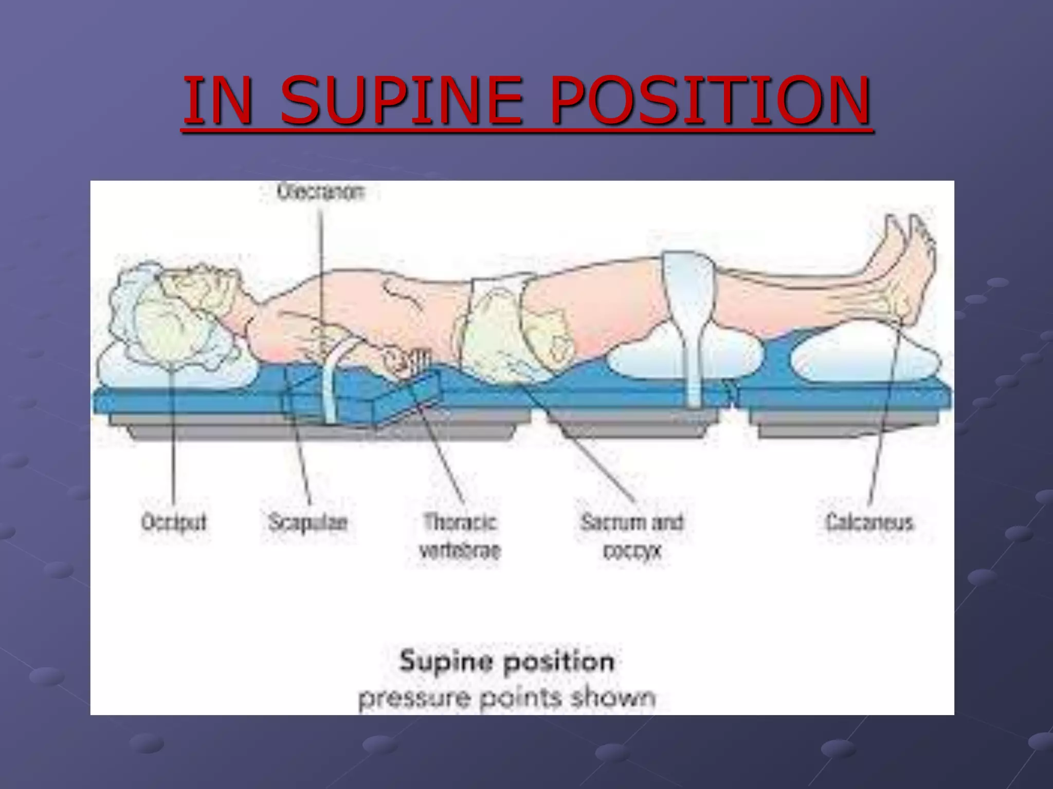 Common pressure points | PPTX