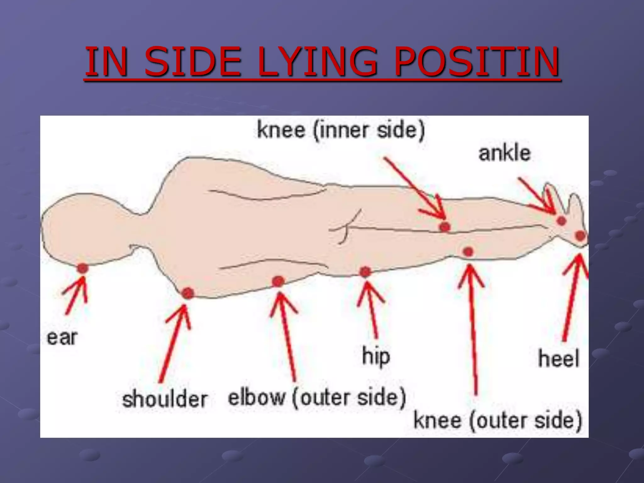 Common pressure points | PPTX