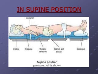 Common pressure points | PPTX