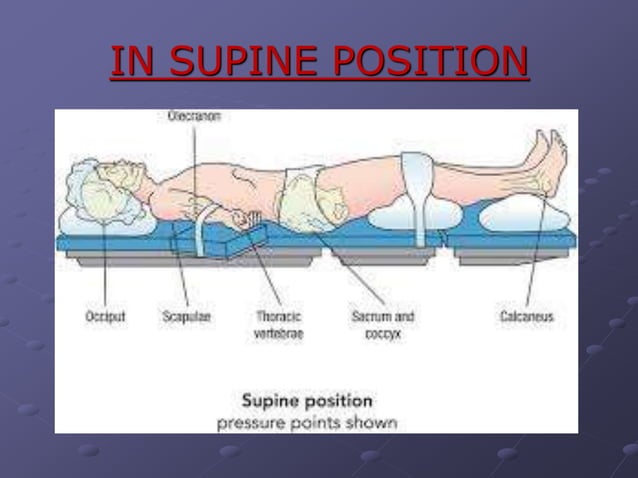 Common pressure points | PPTX