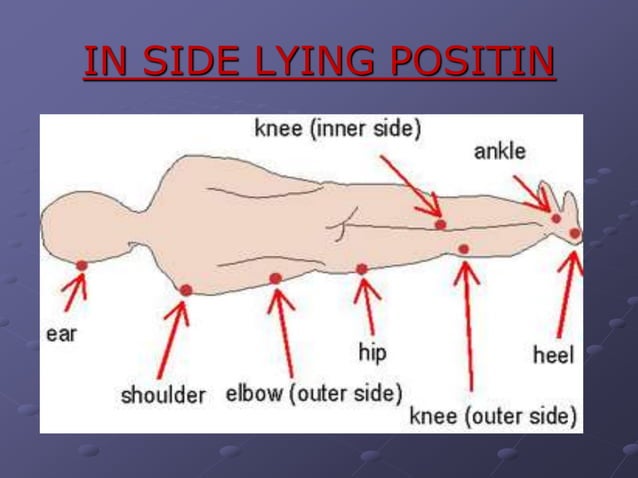 Common pressure points | PPTX