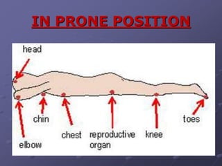 Common pressure points | PPTX