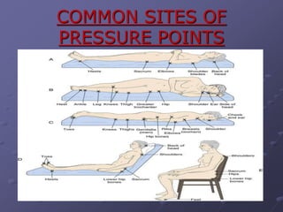 Common pressure points | PPTX